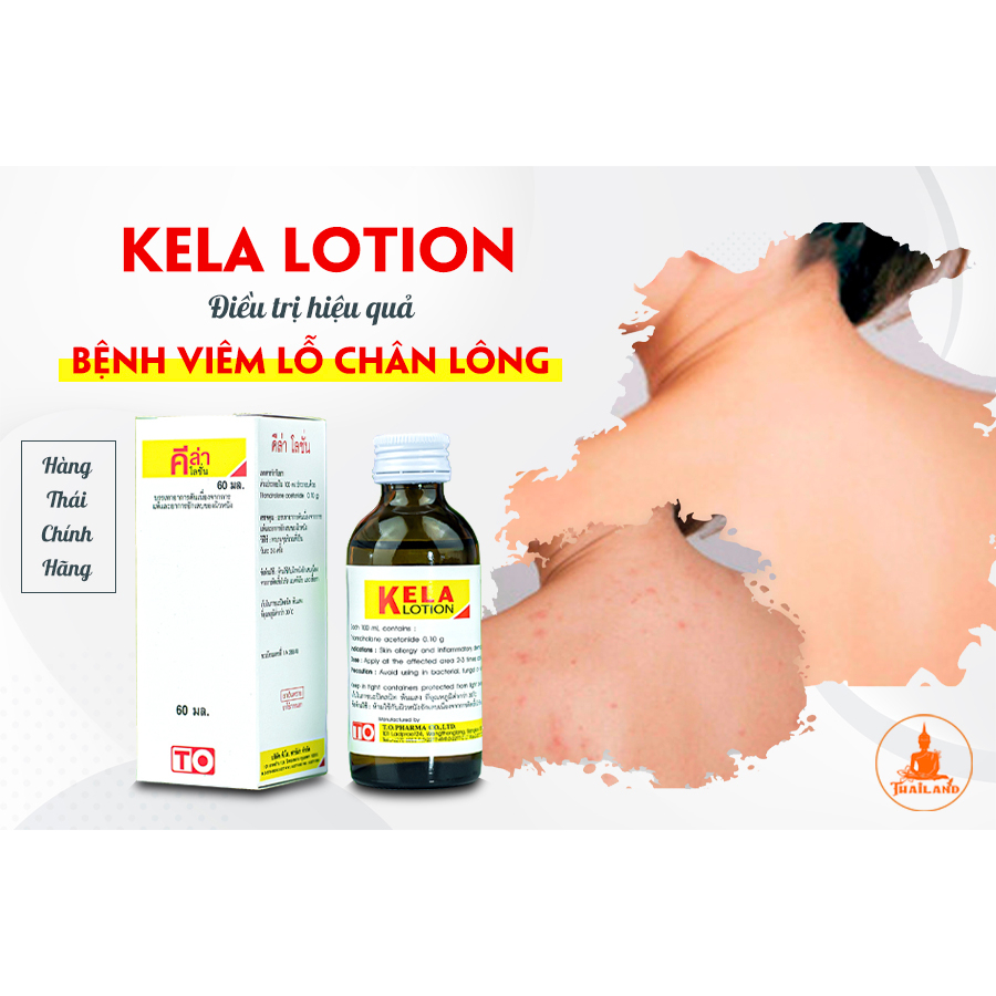 [CHÍNH HÃNG] KELA LOTION dưỡng da Chống Viêm Nang, Lỗ Chân Lông 30ml ...