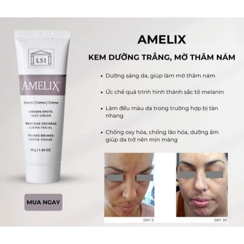 [Hàng công ty] KEM DƯỠNG TRẮNG, LÀM MỜ THÂM NÁM AMELIX FACE CREAM ...