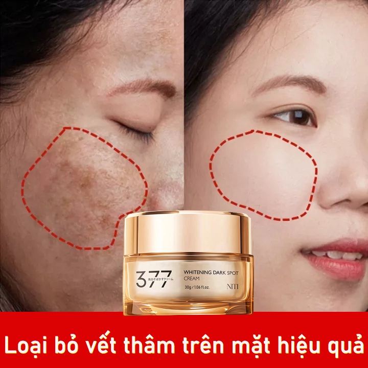 Kem nám tàn nhang chấm tàn nhang kem trắng da mặt 60g Loại bỏ nám tàn ...