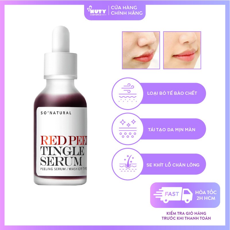 [PHIÊN BẢN MỚI 11ml] Tinh Chất Tái Tạo Da So’ Natural Red Peel Tingle Serum (35ml) | Shopee Việt Nam
