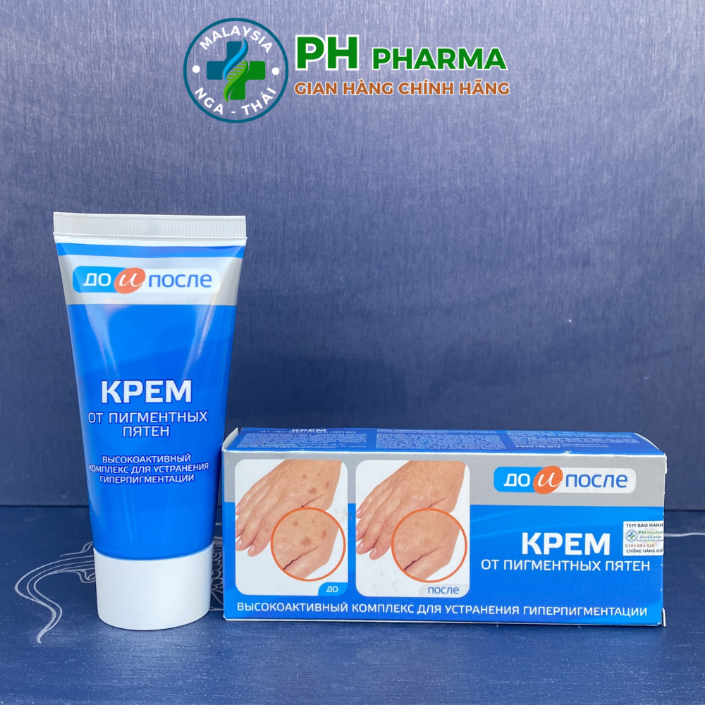 Kem Bôi Giảm Đồi Mồi KPEM Nga - 50ml Làm Giảm Các Đốm Tối Màu Da Tay Cơ ...