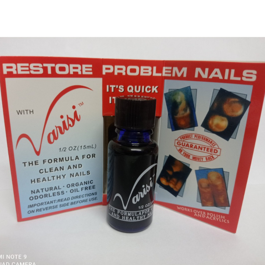 Nấm móng varisi, khắc phục nấm móng varisi | Shopee Việt Nam