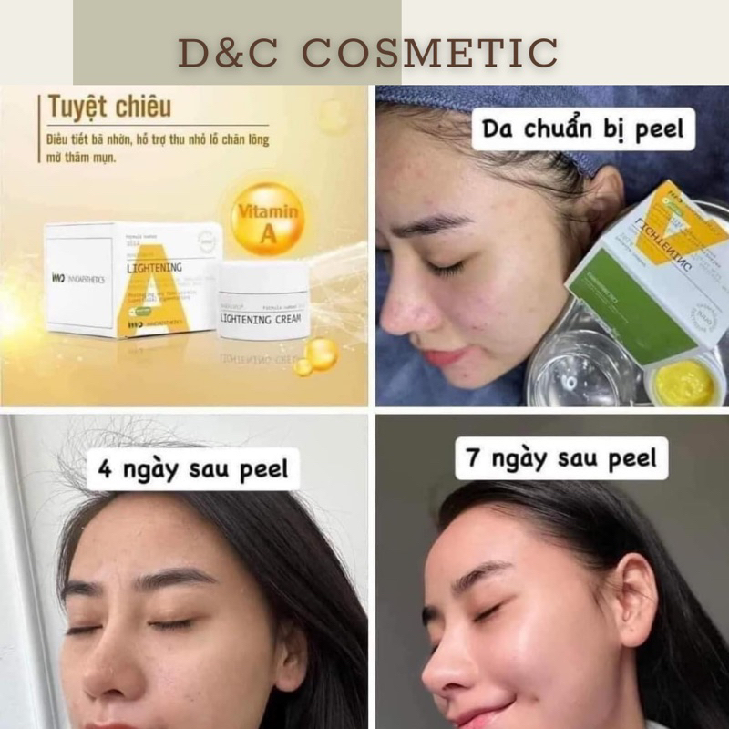 Peel A Inno Hoạt Chất Vitamin A 5% Innoaesthetics Inno LIGHTENING ...