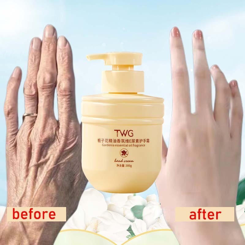 Kem bôi tay 300g Kem Dưỡng Da Tay Kem dưỡng ẩm Ngăn ngừa tay chân khô ...