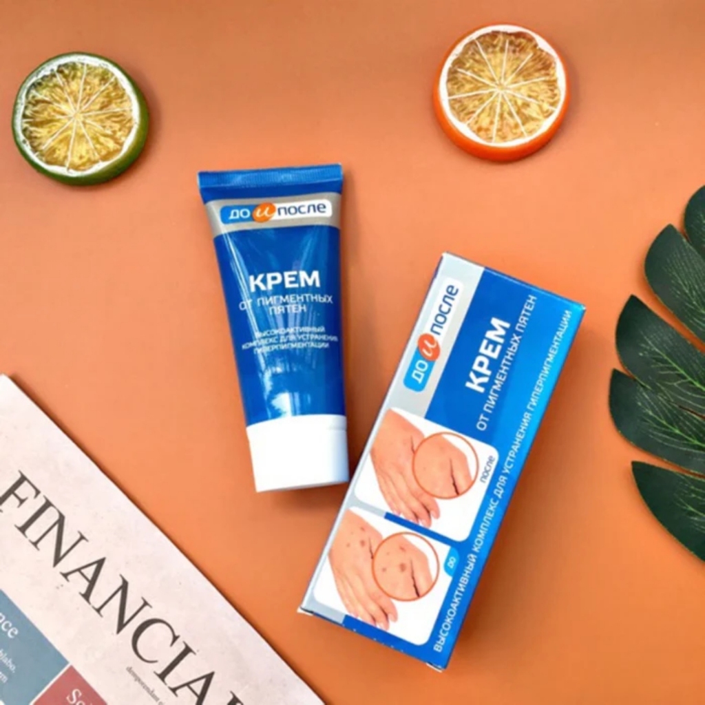 Kem chống đồi mồi Nga - Kem loại bỏ đồi mồi, đốm nâu Kpem | Shopee Việt Nam