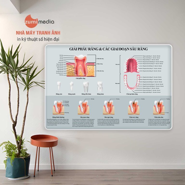 Khung Tranh “giải phẫu Răng và các giai đoạn Sâu Răng” | Shopee Việt Nam