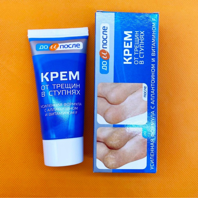 Kem Trị Nứt Gót Chân Kpem Apteka Của Nga 50ml | Shopee Việt Nam