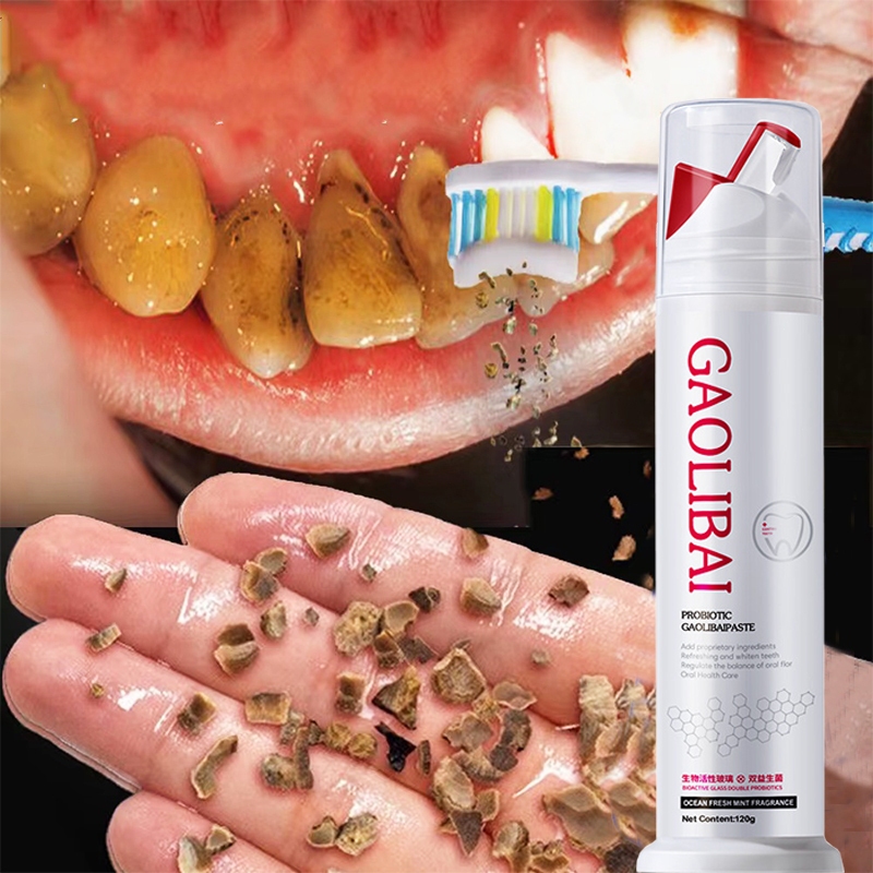 GAOLIBAI chính hãng kem đánh 120g Đánh bật cao răng hỗ trợ làm trắng ...