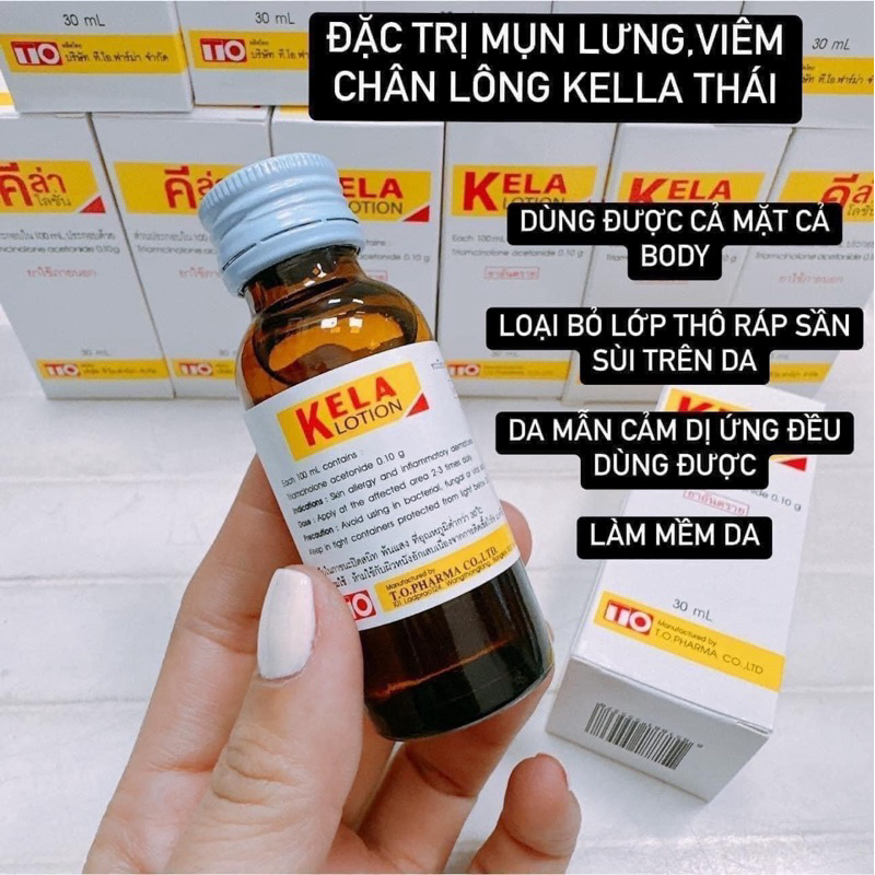 Kela Lotion 60ml Dùng Cho Da Viêm Lỗ Chân Lông Hàng Chính Hãng | Shopee ...