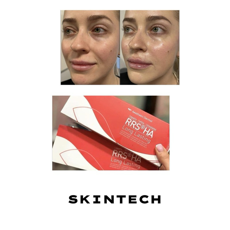 [tem cty] Hoạt Chất B.A.P Làm Đầy Rãnh Cười, Xóa Tan Nếp Nhăn Nâng Cơ - Skintech RRS HA LONG ...