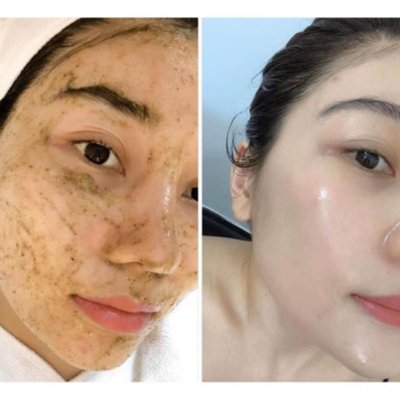 [Công ty] Peel Tảo Ý , Vi Tảo Tái Tạo Làm Căng Bóng Se Khít Lcl - Diego ...