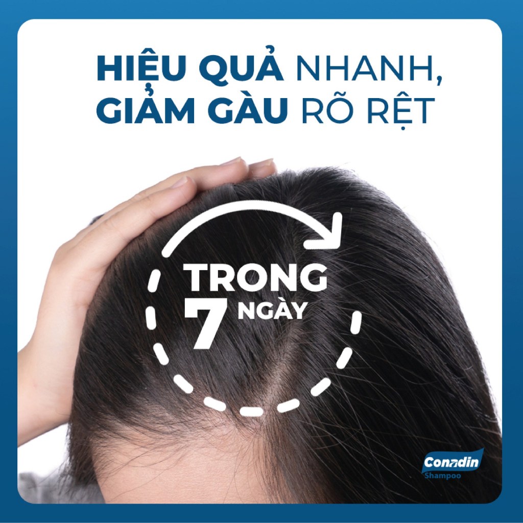 Dầu gội đầu Conadin Shampoo - Sạch Gàu, Giảm Nấm Tóc, Ngứa Da Đầu, Rụng ...