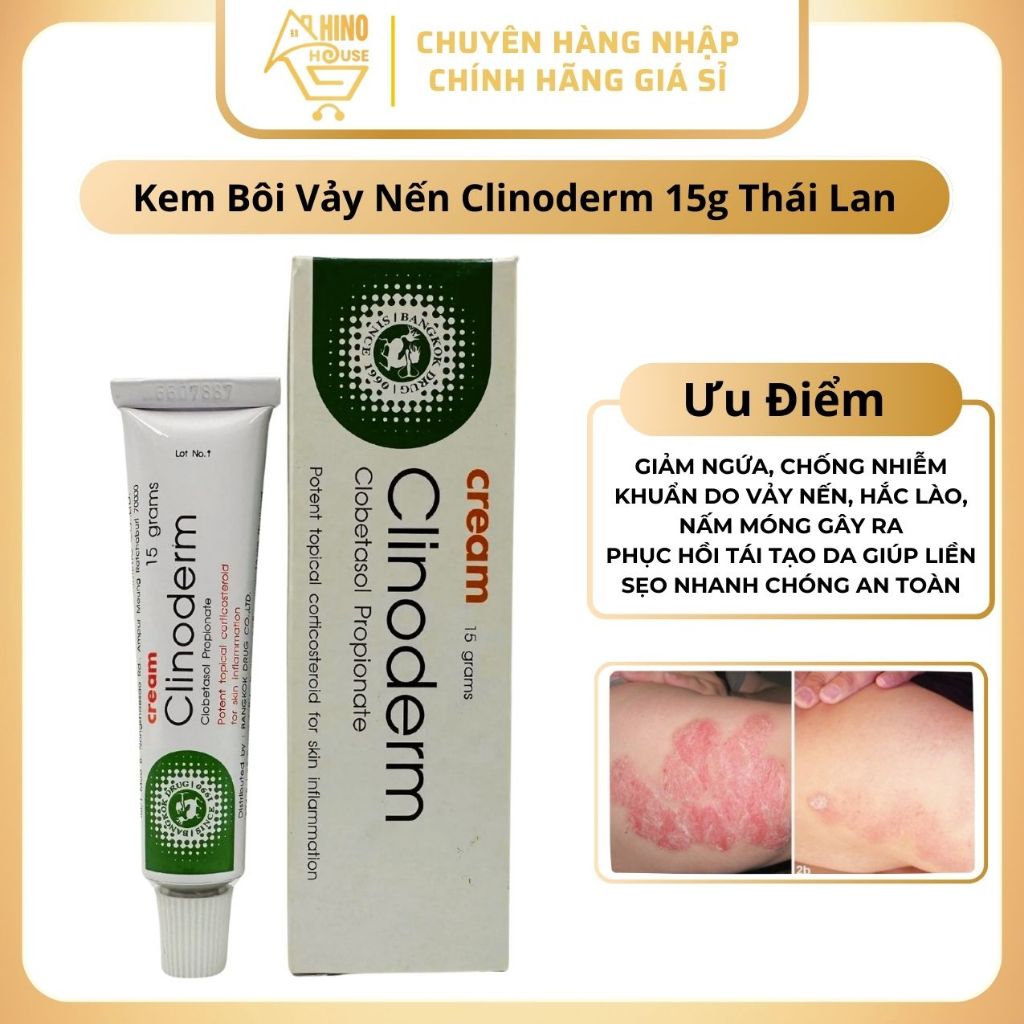 Kem Bôi Vảy Nến Clinoderm 15g Thái Lan Ngăn Ngừa Nấm Móng Tay Chân Vảy ...