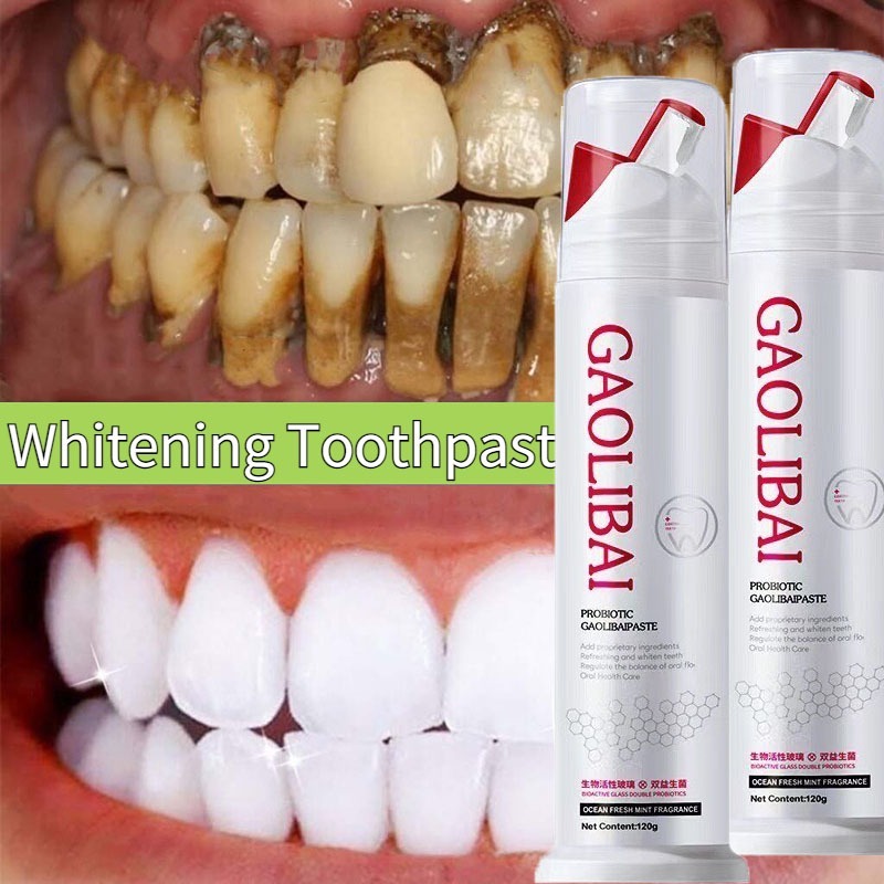 Gel nano bạc GAOLIBAI đánh bật cao răng sạch mảng bám trắng răng cho ...