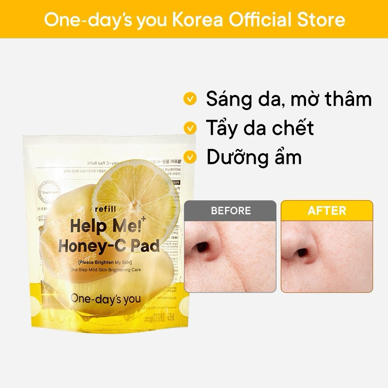 {SẴN} Bông Đắp Toner Sáng Da/ Mờ Thâm/ Giảm Mụn Ẩn | ONE DAY'S YOU ...