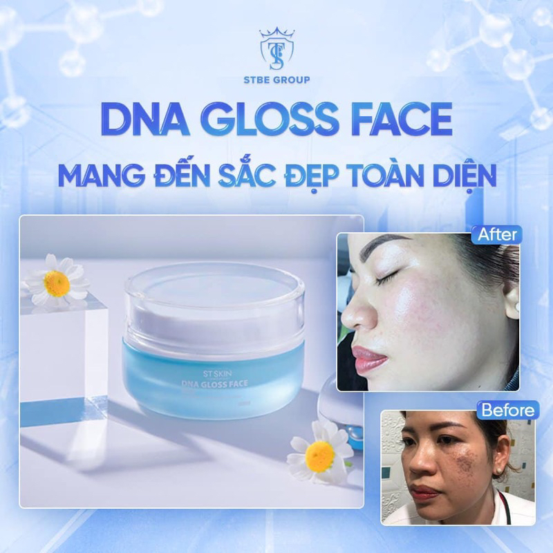 Kem Đêm DNA ST SKIN - Trẻ hoá, săn chắc, căng bóng da | Shopee Việt Nam