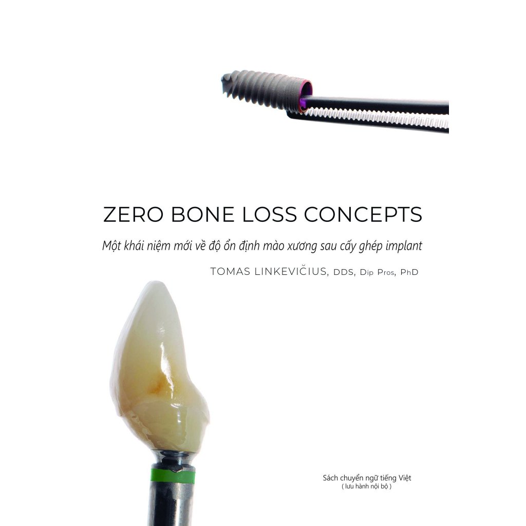 Zero Bone Loss Concepts - Một khái niệm mới về độ ổn định mào xương sau ...