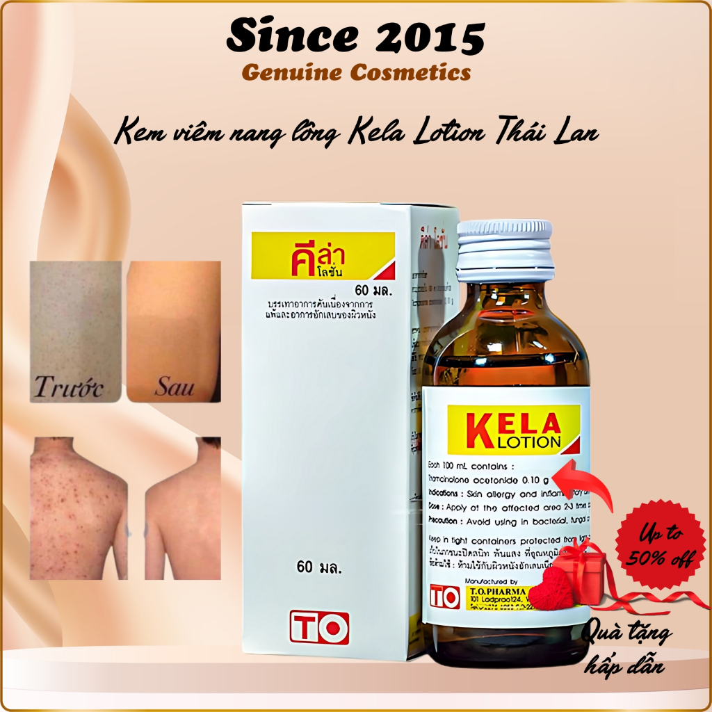 Kela Lotion Dùng Cho Viêm Lỗ Chân Lông, Viêm Nang Lông | Shopee Việt Nam