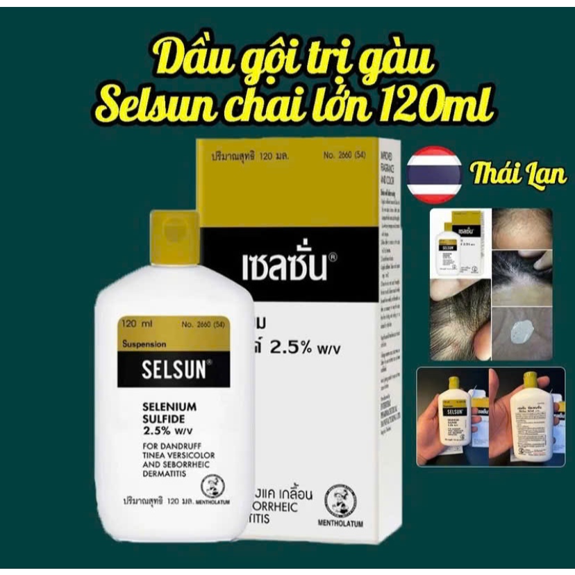 Dầu gội selsun Selenium Sulfide 2.5%.Chai 30ml, 60ml và 120ml | Shopee ...