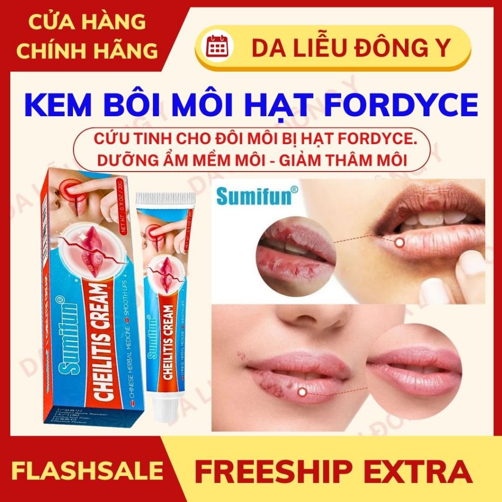[Chính Hãng] Kem bôi môi hạt FORDYCE SUMIFUN dưỡng môi cải thiện môi thâm khô cứu tinh cho đôi ...