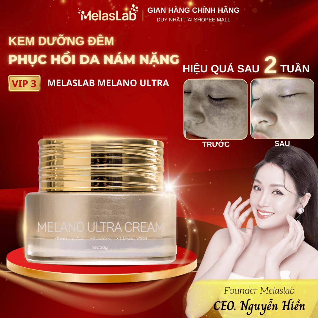 [CHÍNH HÃNG VIP3] Kem Nám Tàn Nhang MELASLAB MELANO ULTRA CREAM Giúp Phục Hồi Và Làm Dịu Cho Da ...