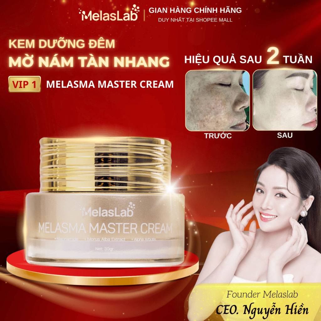 [CHÍNH HÃNG VIP1] Kem dưỡng mờ nám MELASMA MELASLAB MASTER CREAM ban đêm mờ nám tàn nhang dưỡng ...