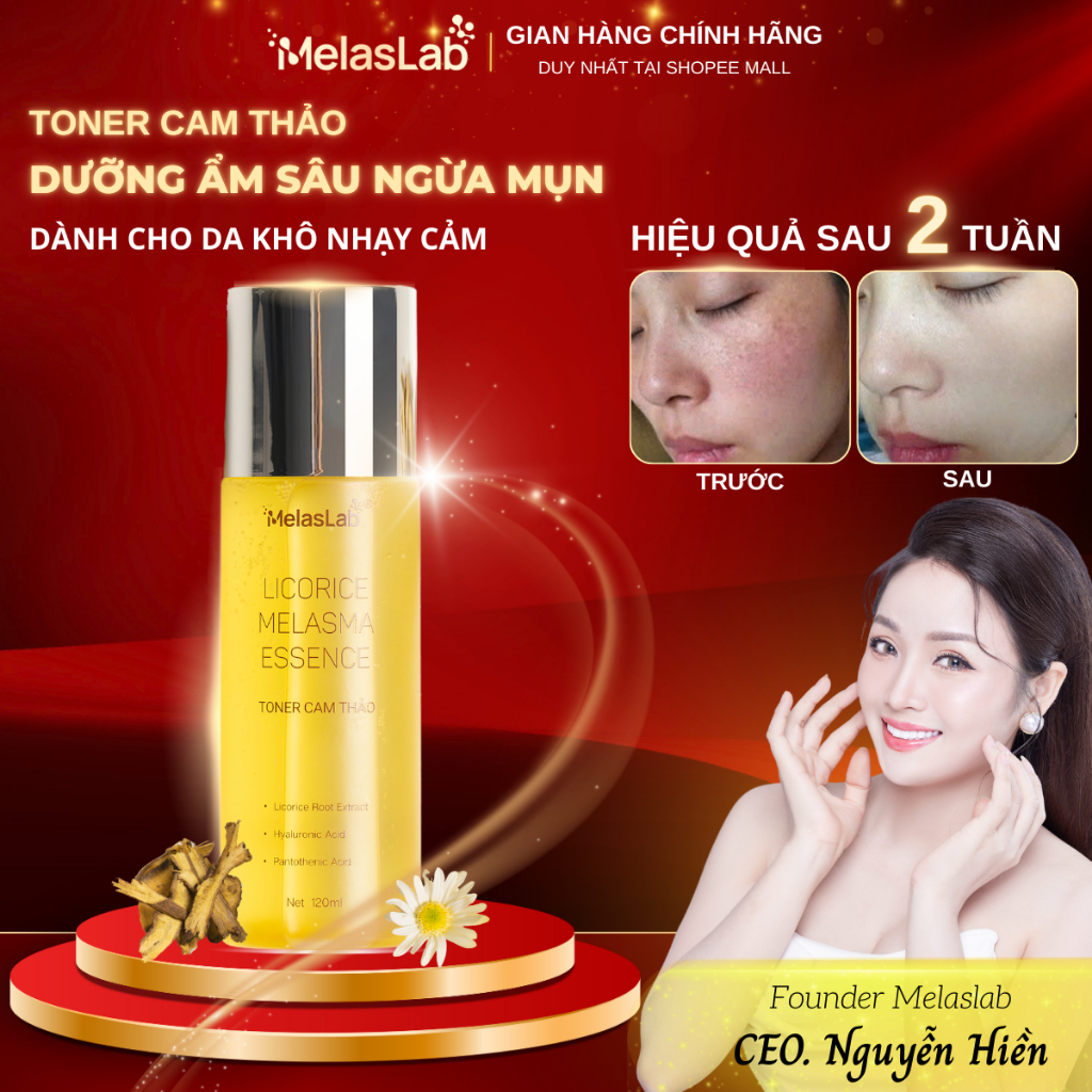 Toner Cam Thảo MELASMA LICORICE ESSENCE, Toner Dưỡng Da Căng Bóng Hỗ ...