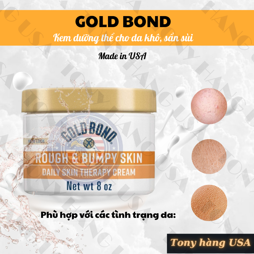 Kem Dưỡng Da Body, Cổ Và Tay Gold Bond Ultimate Rough & Bumpy Skin ...