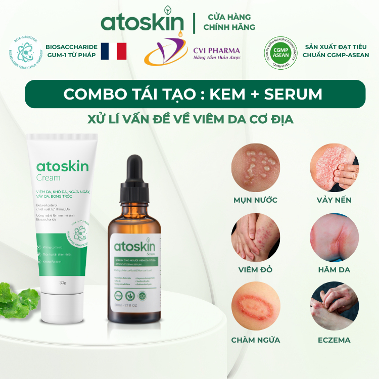Combo Serum viêm da cơ địa Atoskin + Kem bôi viêm da cơ địa Atoskin ...