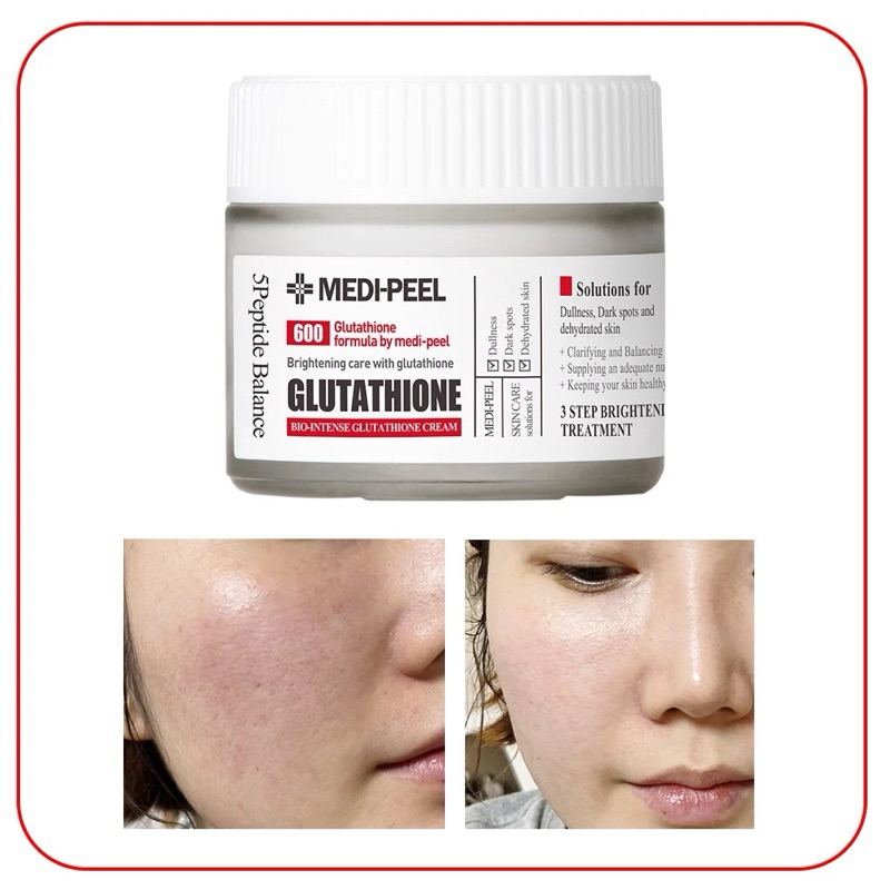 Kem dưỡng trắng da Medipeel Glutathione 50g | Shopee Việt Nam