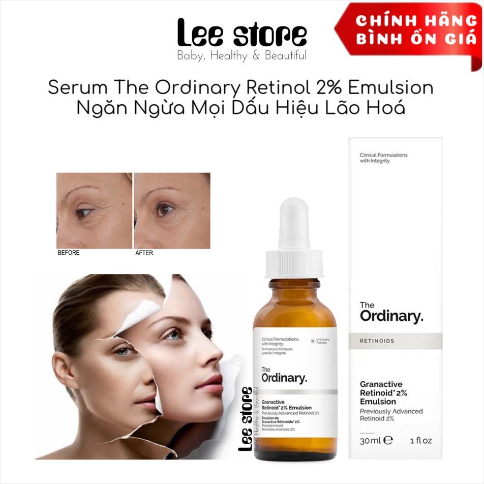 [CANADA] Serum THE ORDINARY Retinol 2% Emulsion Chống Lão Hóa, Xạm Nha, Nếp Nhăn 30ml | Shopee ...