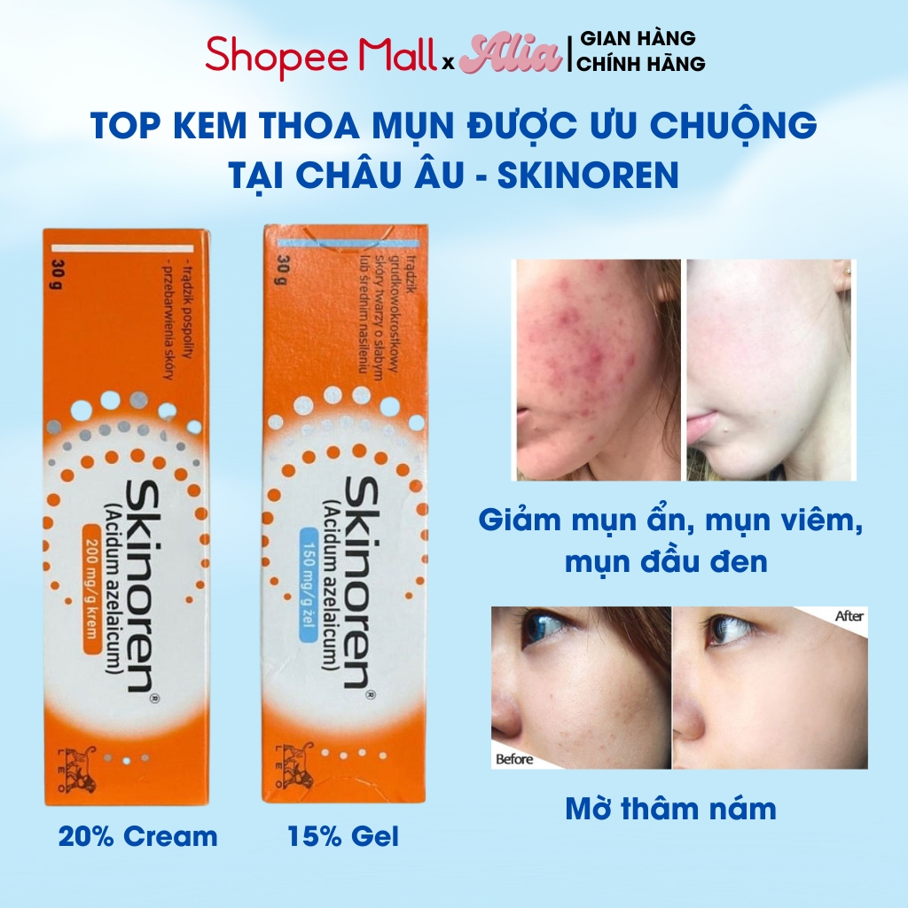 Kem bôi mụn skinoren 20% Acid azelaic 30g Ba Lan giảm sự hình thành mụn ...
