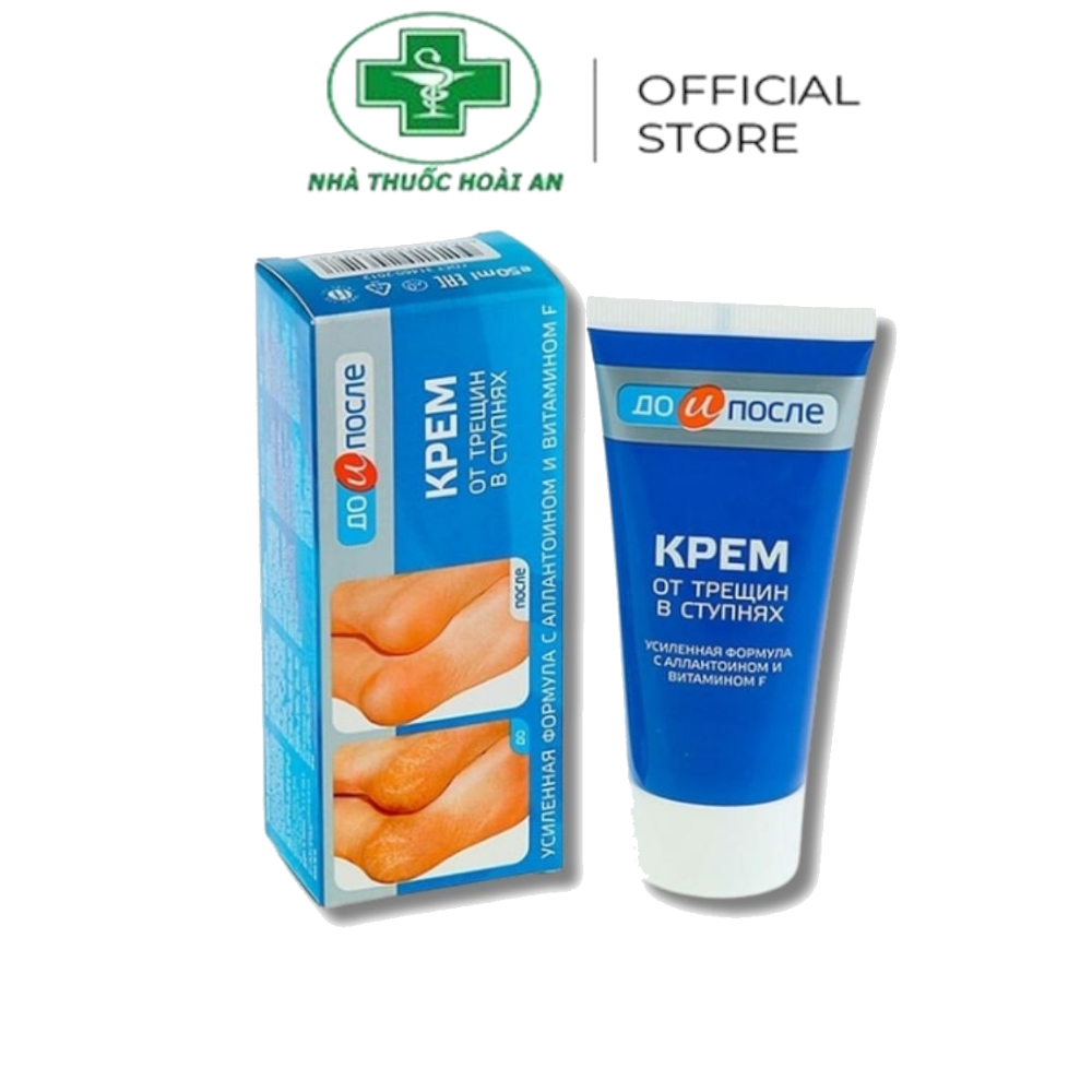 Kem Giảm Và Phục Hồi Nứt Nẻ Gót Chân Kpem 50ml hàng chính hãng Nga ...