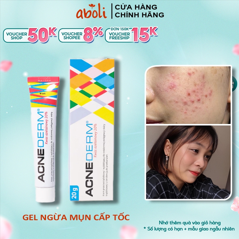 Kem giảm mụn, giảm sẹo làm trắng da Acne Derm 20% Azelaic (Acnederm ...