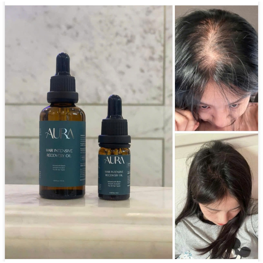 [HỎA TỐC] Dầu Ủ Tóc Phục Hồi AURA, Oil Ủ Tóc Hỗ Trợ Nuôi Dưỡng Da Đầu Và Nang Tóc, Oil Aura Hỗ ...