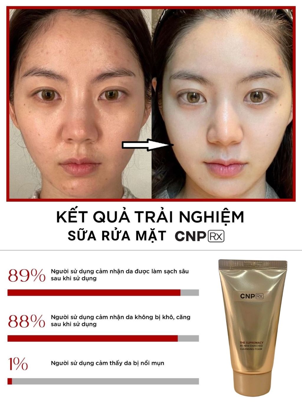 Chai Sữa Rửa Mặt CNP Rx Vàng Supremacy Cleansing Foam 60mL | Shopee Việt Nam