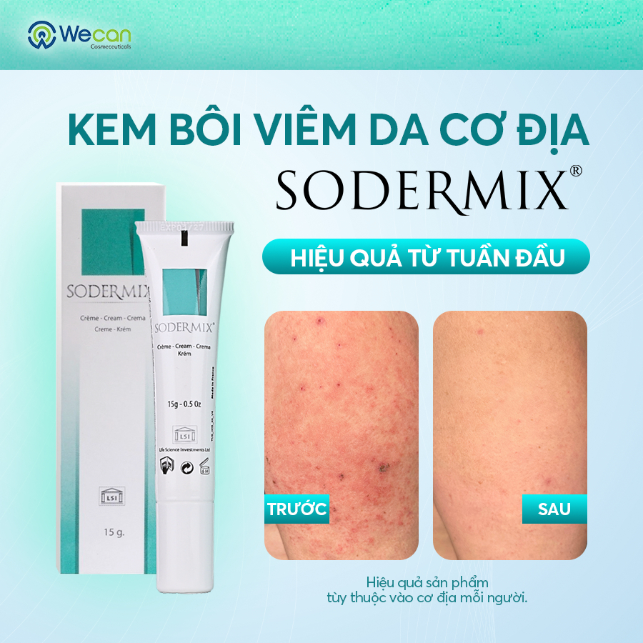 SODERMIX - Kem Bôi Viêm Da Cơ Địa Hỗ Trợ Giảm Ngứa Ngáy, Eczema, Chàm ...