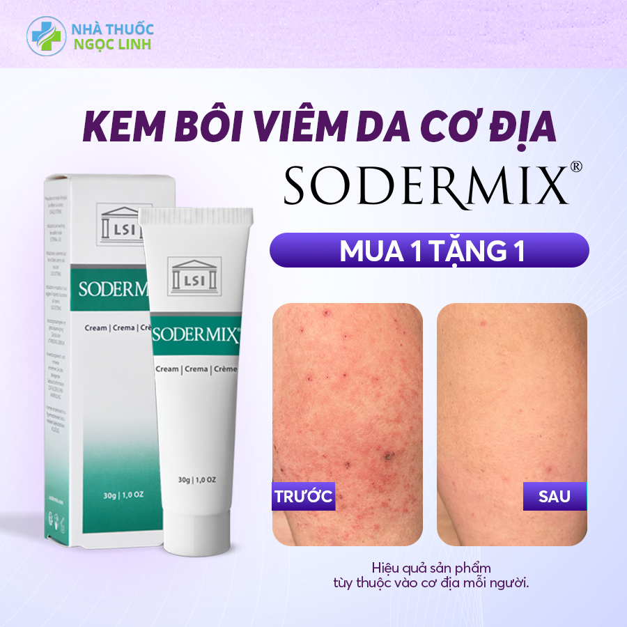 Kem Bôi Sodermix Tuýp 30gr - Hỗ Trợ Viêm Da Cơ Địa Lâu Năm, Ngứa Ngáy ...