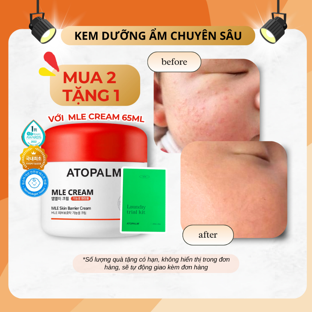 Kem dưỡng MLE Atopalm giúp dưỡng ẩm, làm dịu làn da khô, chàm sữa, VDCĐ ...