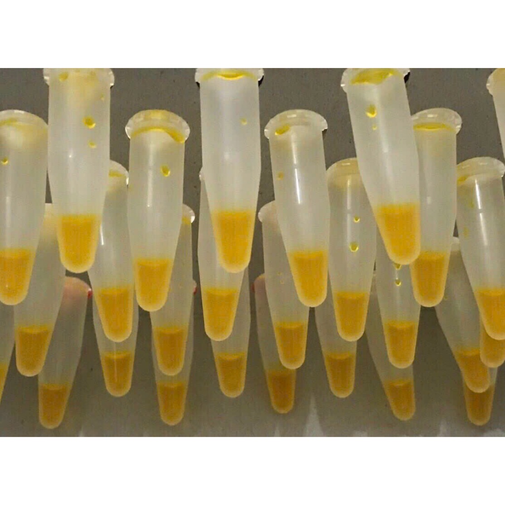 Hộp que test xét nghiệm nhanh UREA- H.Pylori Nội soi ( Hộp 100 que test ...