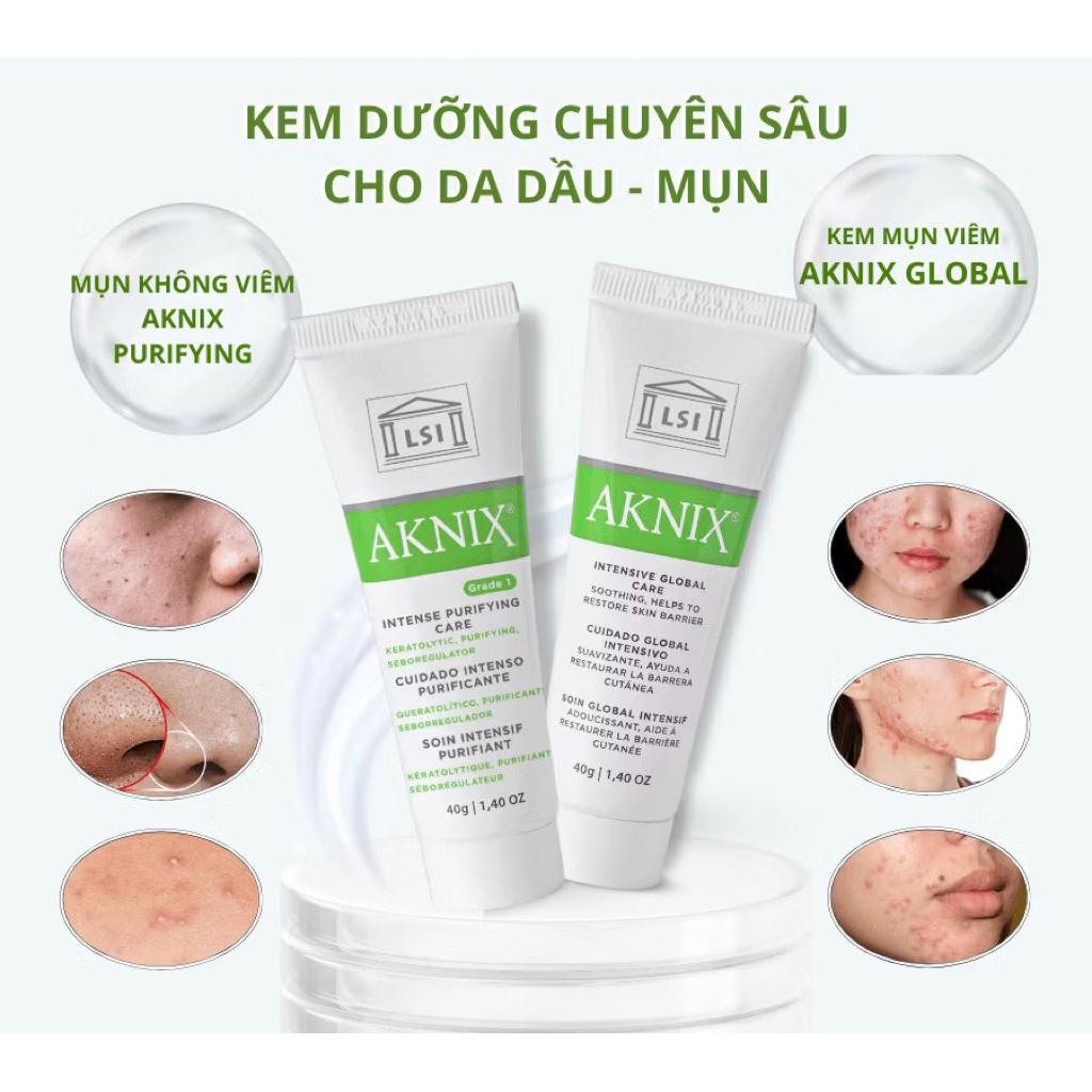 Kem Dưỡng AKNIX Chuyên Biệt Cho Da Dầu Mụn 40g, Nhập Khẩu Pháp - cho da ...