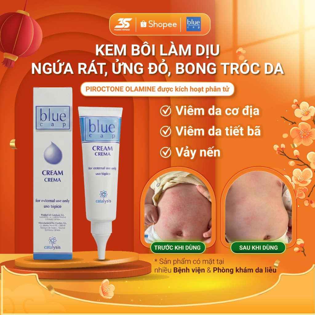 Kem Bôi Viêm Da Cơ Địa Blue Cap Cream 50g, Viêm Da Dị Ứng, Vảy Nến ...