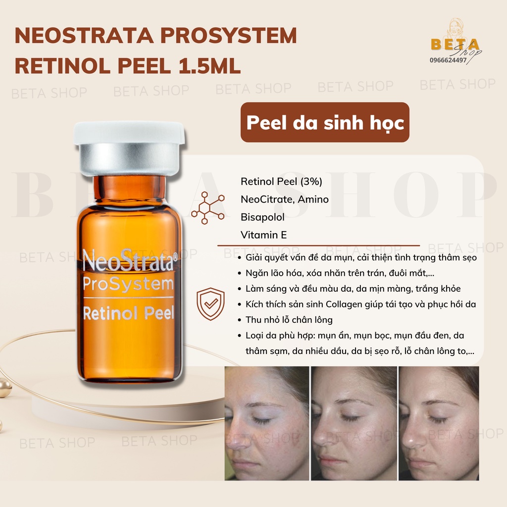 Peel da tẩy tế bào chết NeoStrata ProSystem Retinol giảm lão hóa, se ...
