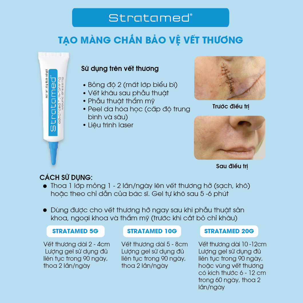 Gel Silicon bảo vệ và làm lành vết thương hở Stratamed | Shopee Việt Nam