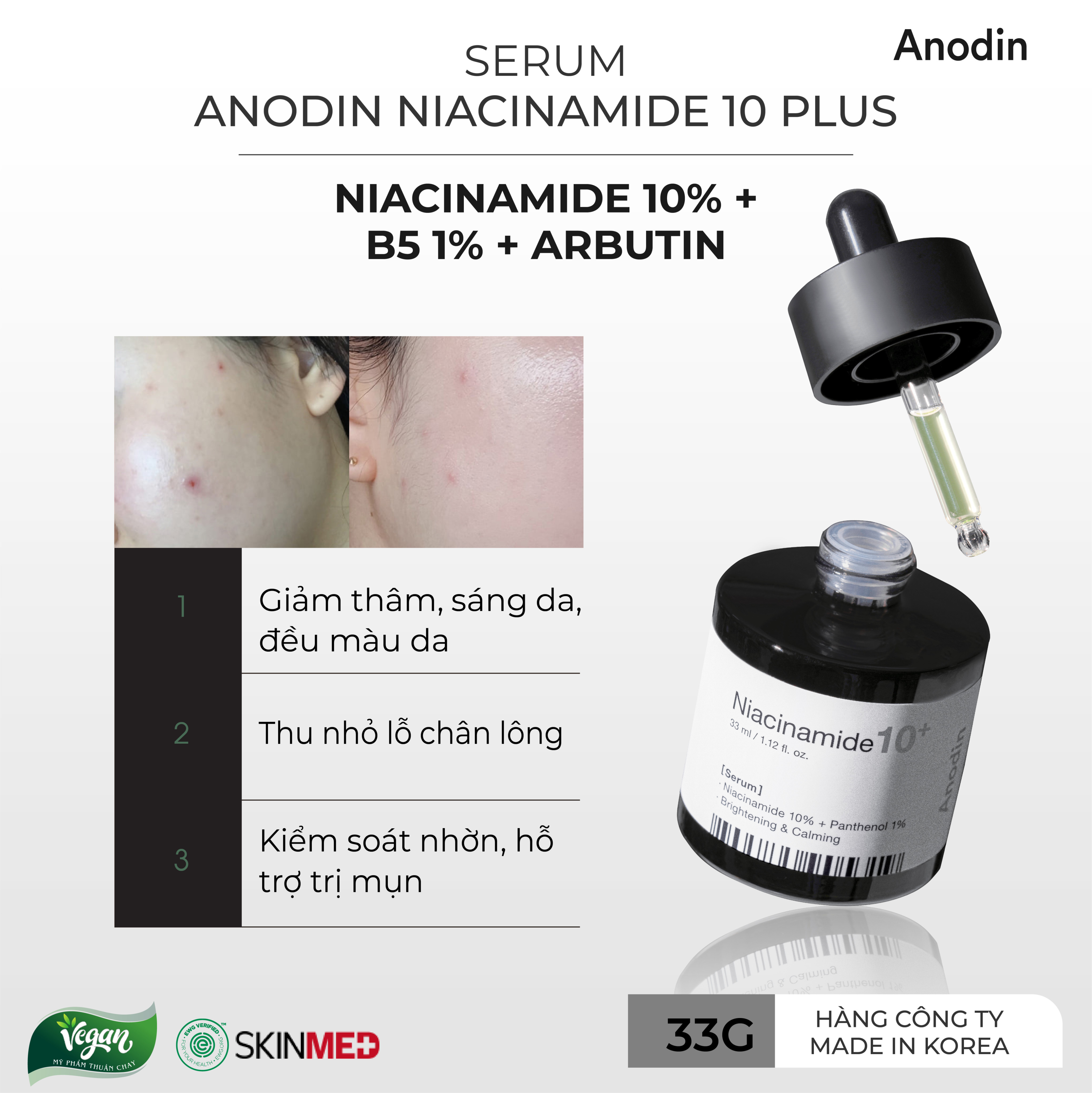 Tinh chất dưỡng trắng và mờ thâm Anodin Niacinamide 10 Plus | Shopee ...