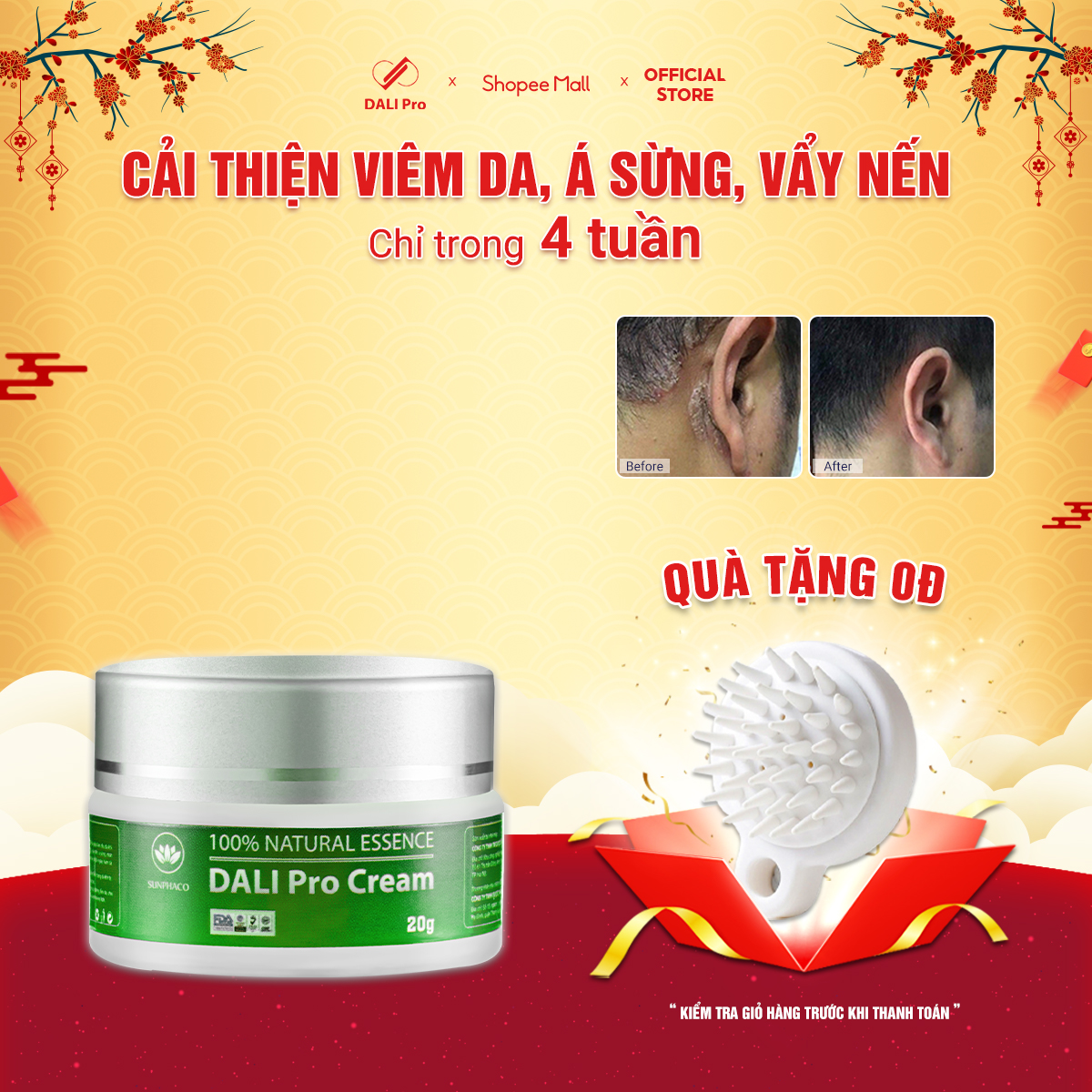 Kem Bôi Da DALI PRO Hỗ Trợ Vảy Nến, Viêm Da Cơ Địa, Viêm Da Tiết Bã, Nấm Da, Hắc Lào, Nấm Ngứa ...