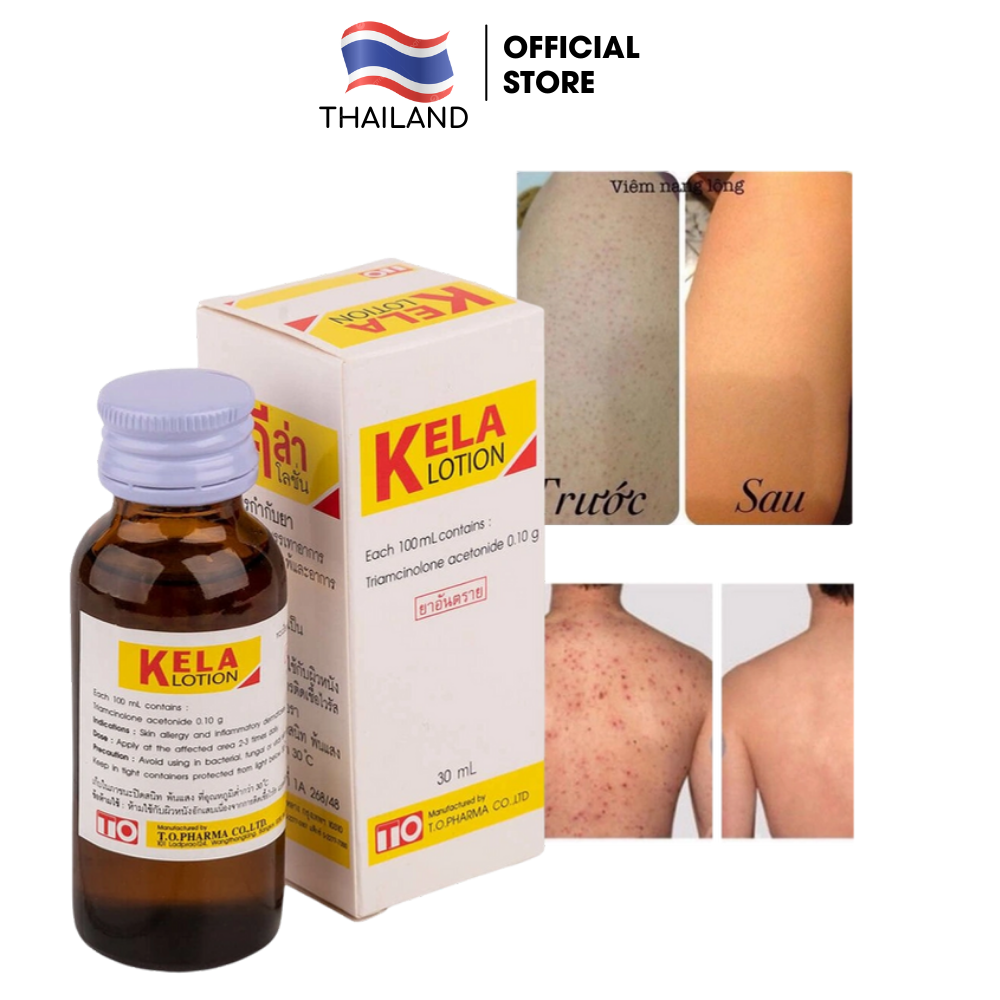 Viêm nang lông Kela, viêm lỗ chân lông kela lotion thảo dược Thái Lan ...