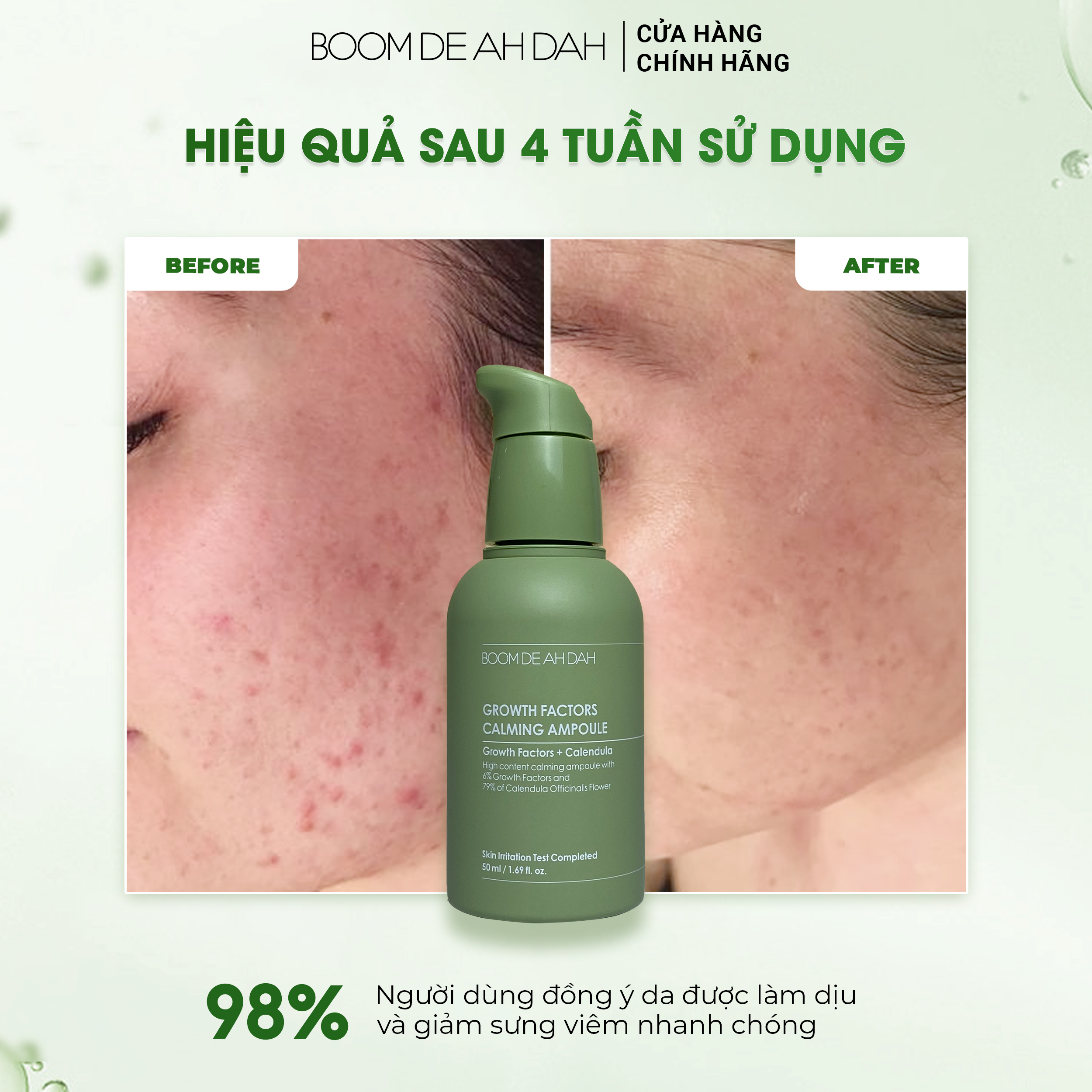 Serum Giúp Phục Hồi, Giảm Mụn Boom De Ah Dah Growth Factors Calming Ampoule 50ml (XANH LÁ ...