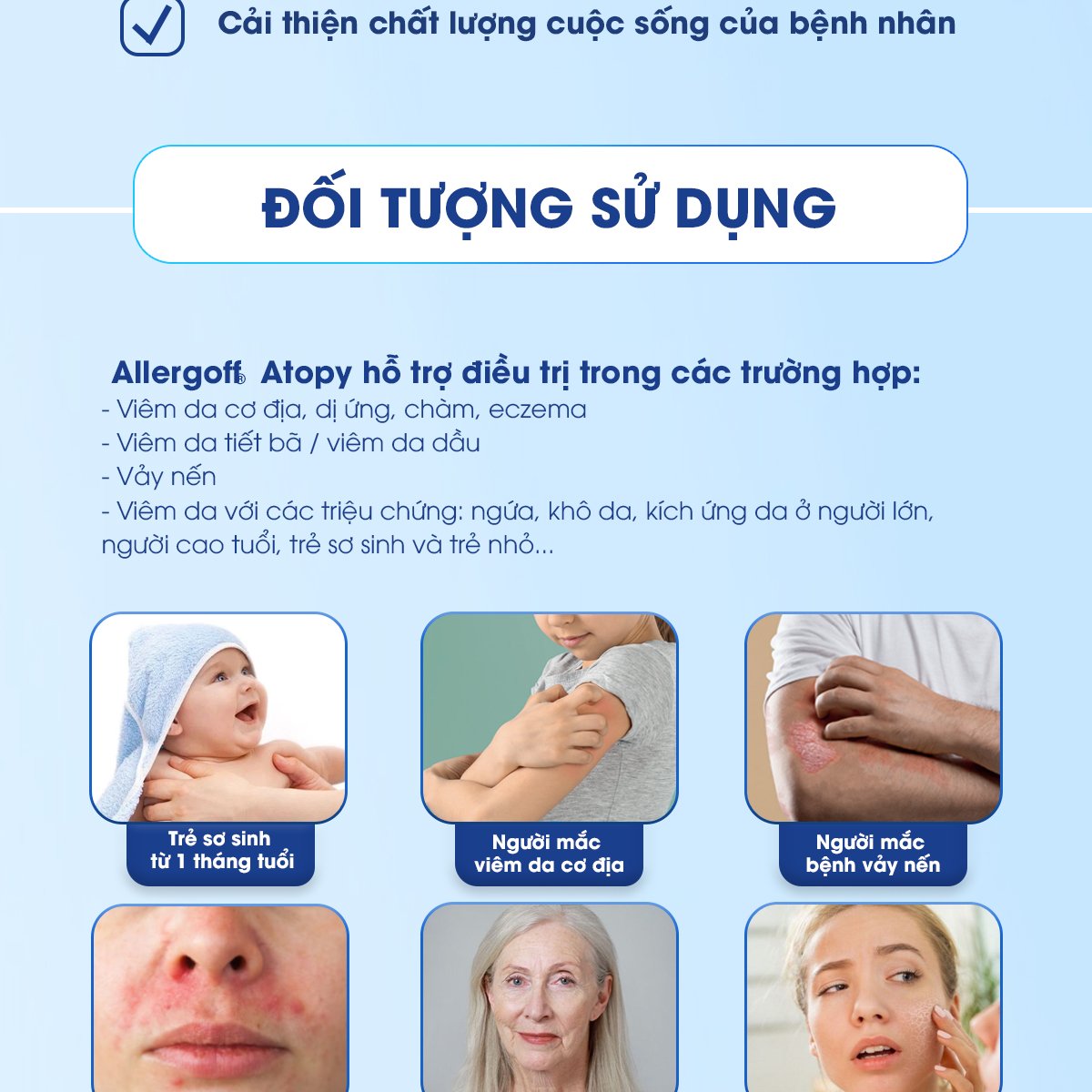 Kem dưỡng ẩm dịu ngứa Allergoff atopy - Allergoff barrier cream for ...
