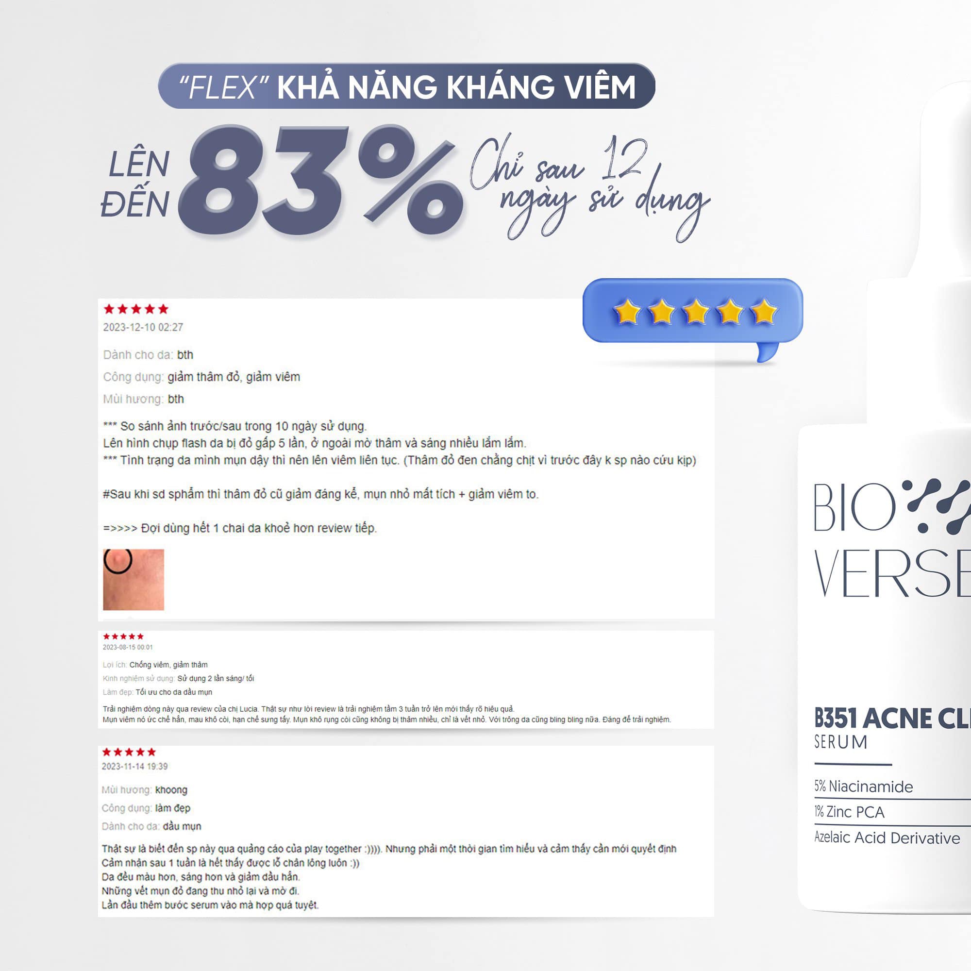 Sample Tinh Chất Niacinamide 5% + Zinc 1% Hỗ Trợ Mụn Bioverse B351 Acne Clear Up Serum 5ml ...